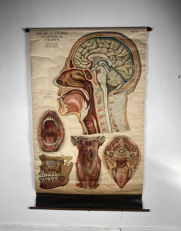 1918 American Frohse Anatomical Chart, A. J. Nystrom, Max Brodel ...