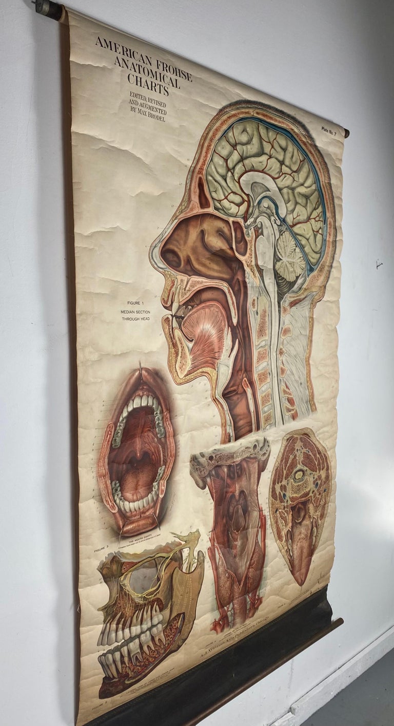 1918 American Frohse Anatomical Chart, A. J. Nystrom, Max Brodel ...