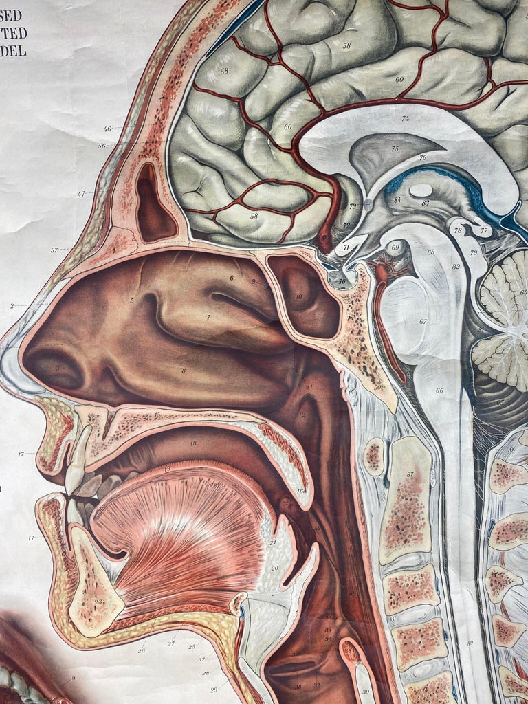 1918 American Frohse Anatomical Chart, A. J. Nystrom, Max Brodel ...