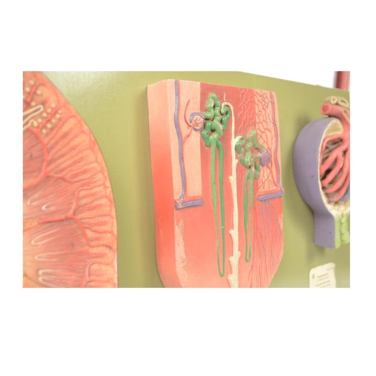 1950s Vintage Somso Anatomical Medical Didactic Model of kidney For ...