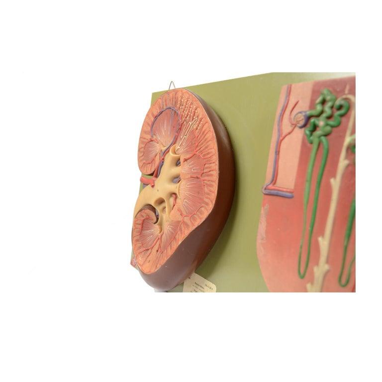 1950s Vintage Somso Anatomical Medical Didactic Model of kidney For ...
