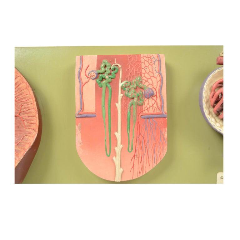 1950s Vintage Somso Anatomical Medical Didactic Model of kidney For ...