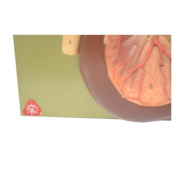 1950s Vintage Somso Anatomical Medical Didactic Model of kidney For ...