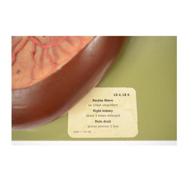 1950s Vintage Somso Anatomical Medical Didactic Model of kidney For ...