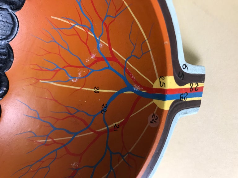 1960s Vintage Italian Anatomical Human Left Eye Model in Plastic by ...