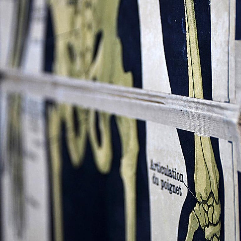 19th Century French Émile Deyrolle Anatomical Lithograph Poster For ...