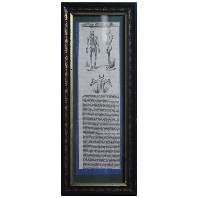 19th Century George IV the Living Skeleton 1825 Freak Show ...