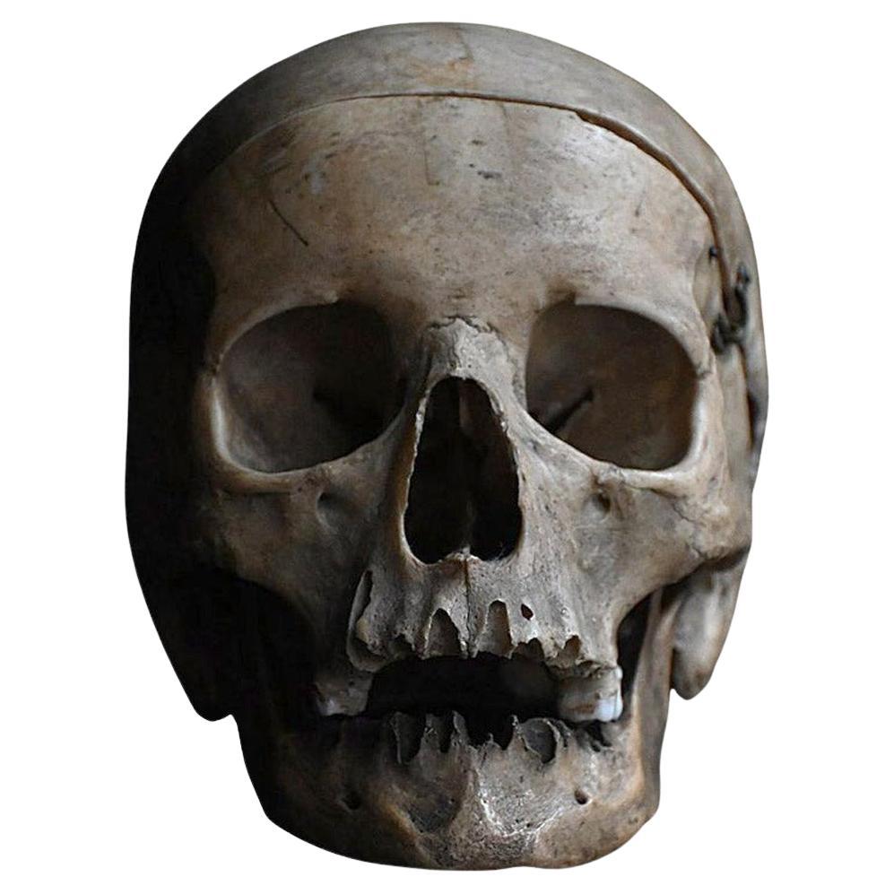 19th Century Human Medical Natural History Skull Example For Sale at ...