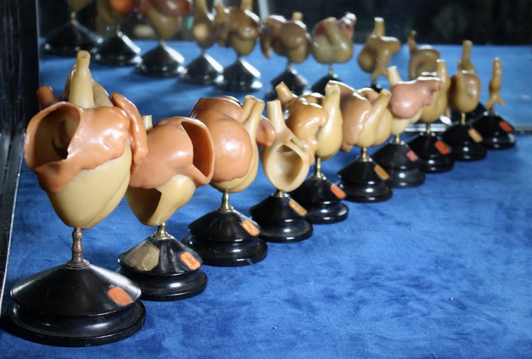 19th C Wax Anatomical Models Human Heart Growth Scientific Medical F ...