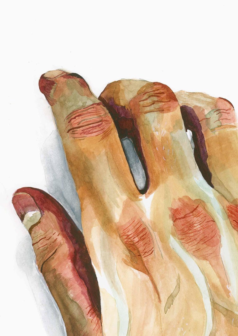 Marie Tooth - Agoraphobia - Print, Watercolor, Hyperrealism ...