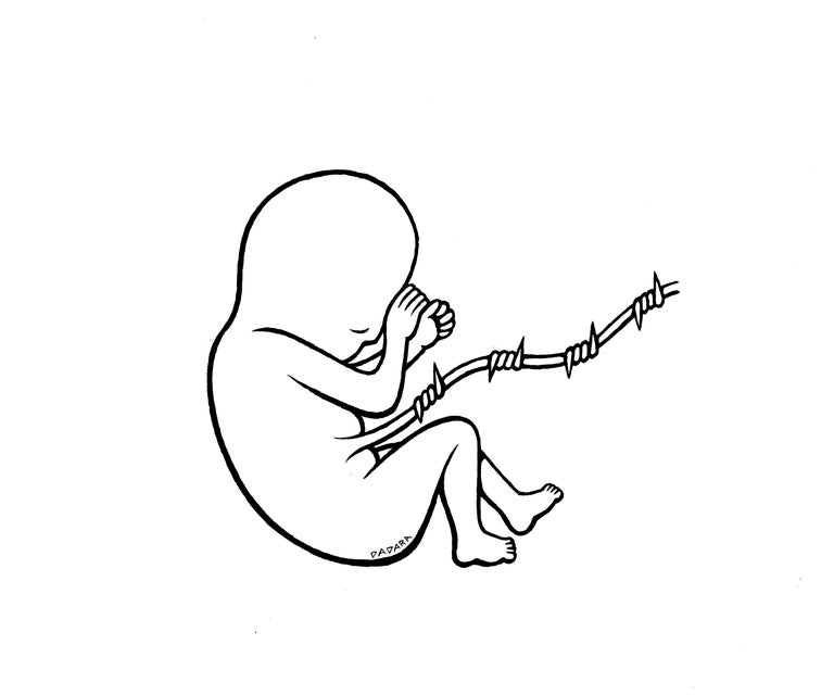 Dadara - Barbwire Fetus For Sale at 1stDibs