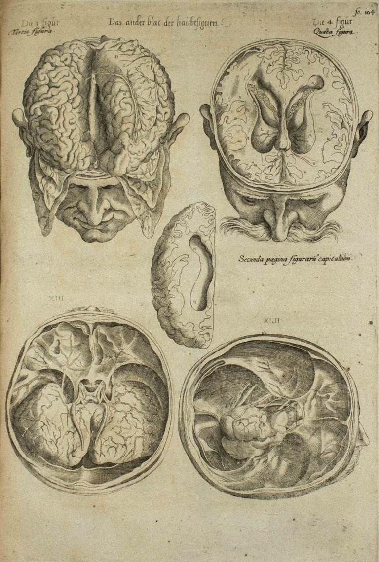 Andrea Vesalio - The Brain - Etching - "De Humani Corporis Fabrica ...
