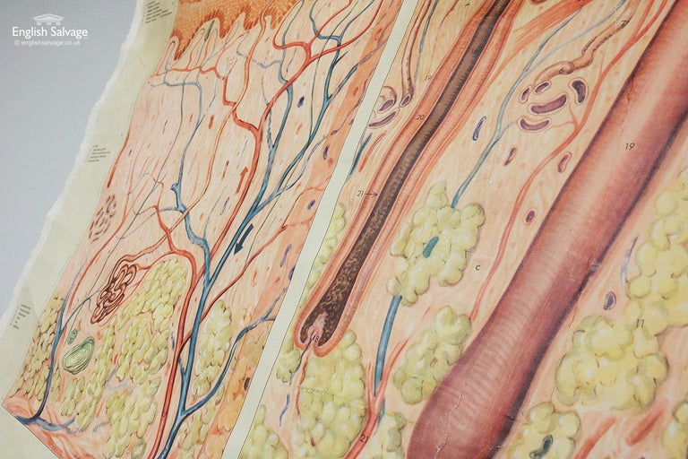 Adam Rouilly Medical Chart, Skin and Tongue, 20th Century For Sale at ...