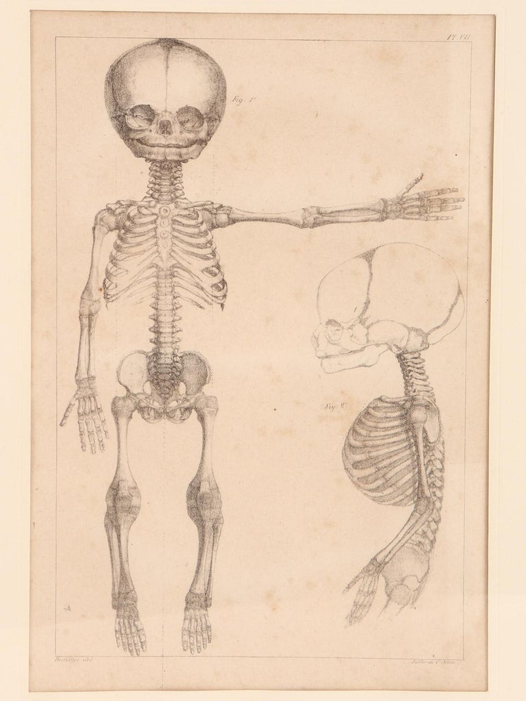 Anatomical Print on Paper, Depicting a Fetus Skeleton, France, 19th ...