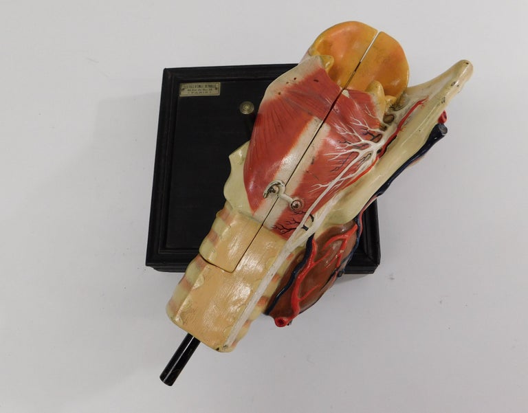 Anatomie Humaine Plaster Model of Larynx by Maison Deyrolle, Paris ...