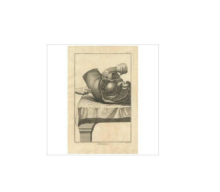 Antique Medical Print of a Lateral Section of the Hypogastrium, Abdomen ...