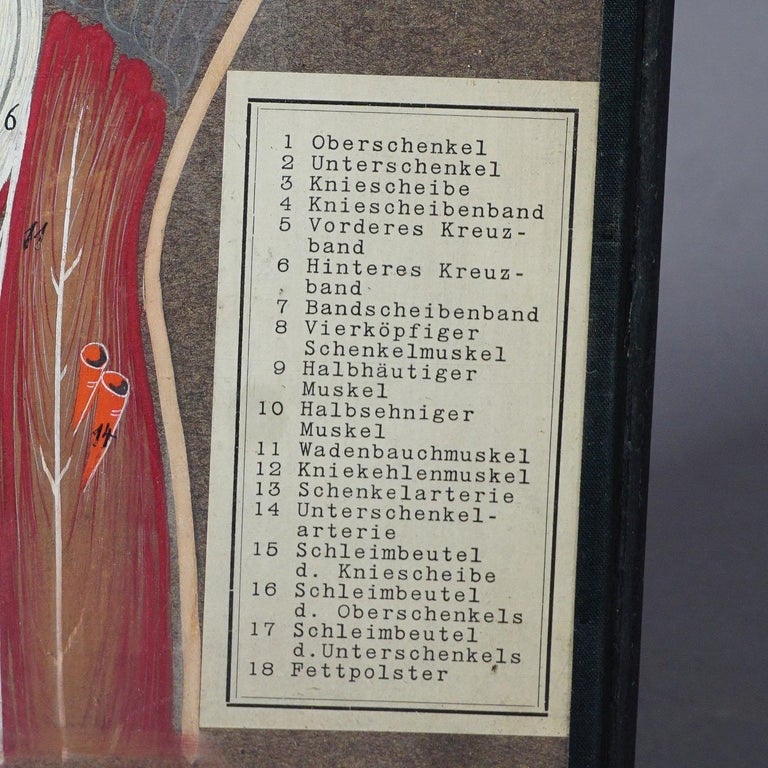 Antique Scientific Demonstration Model, Bone Cut of the Human Knee ...