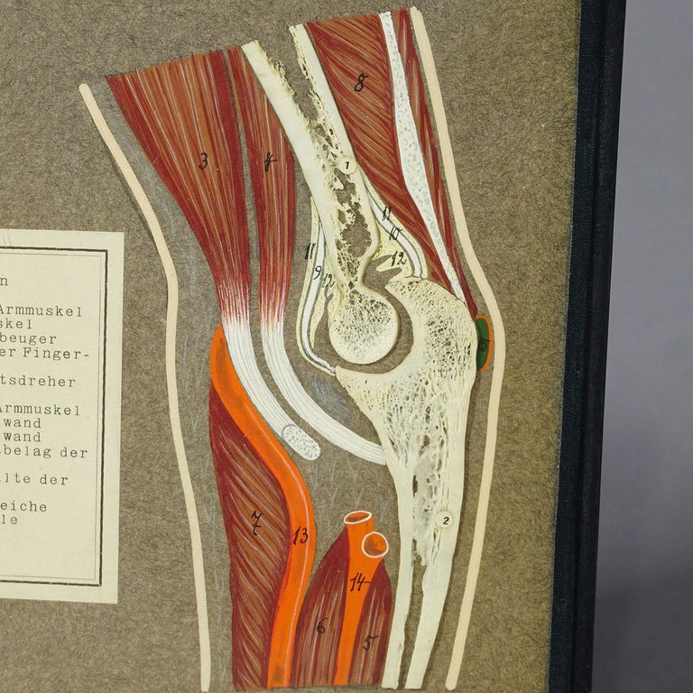 Antique Scientific Visual Aid, Bone Cut of the Human Elbow For Sale at ...