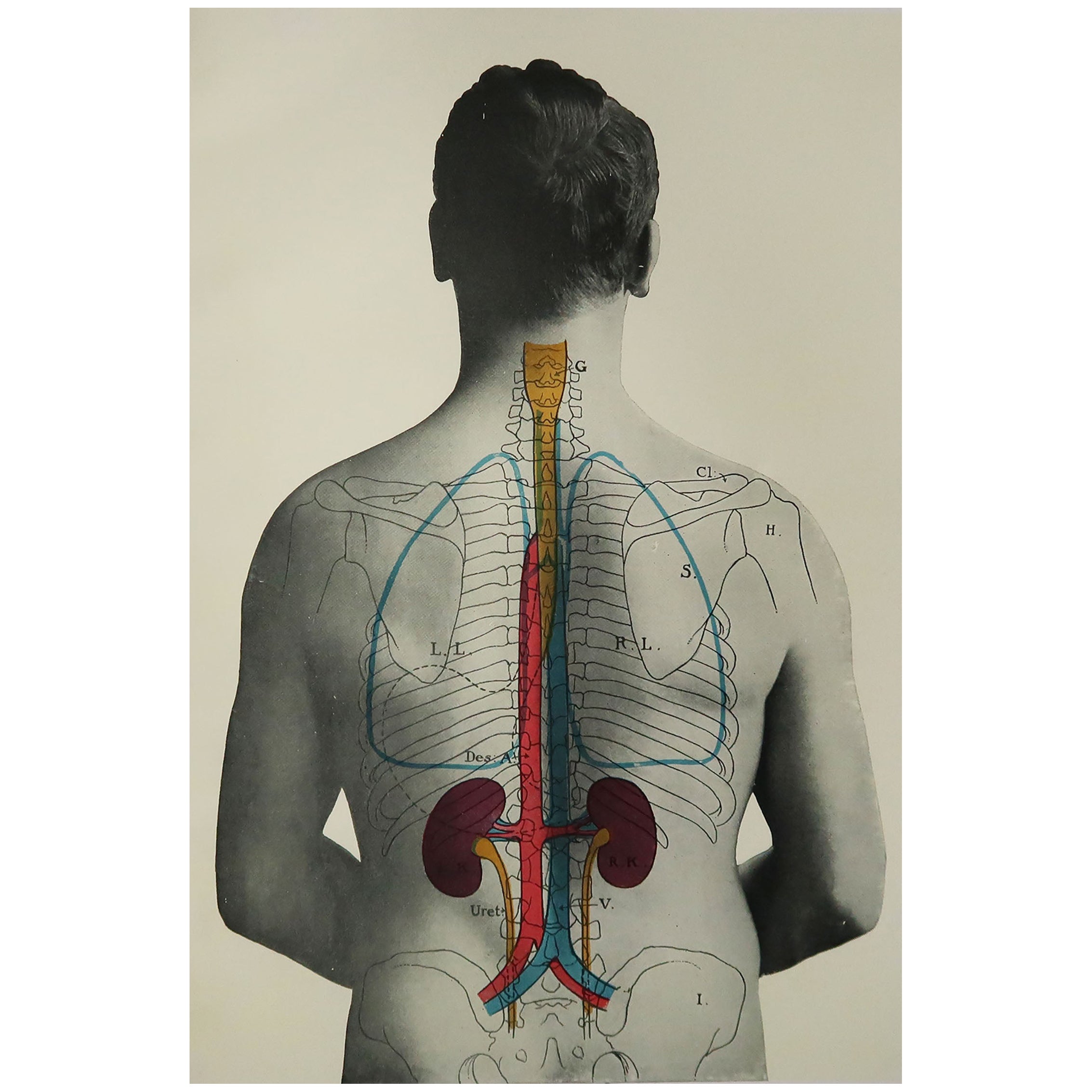Original Vintage Medical Print- Kidneys, C.1900 at 1stDibs