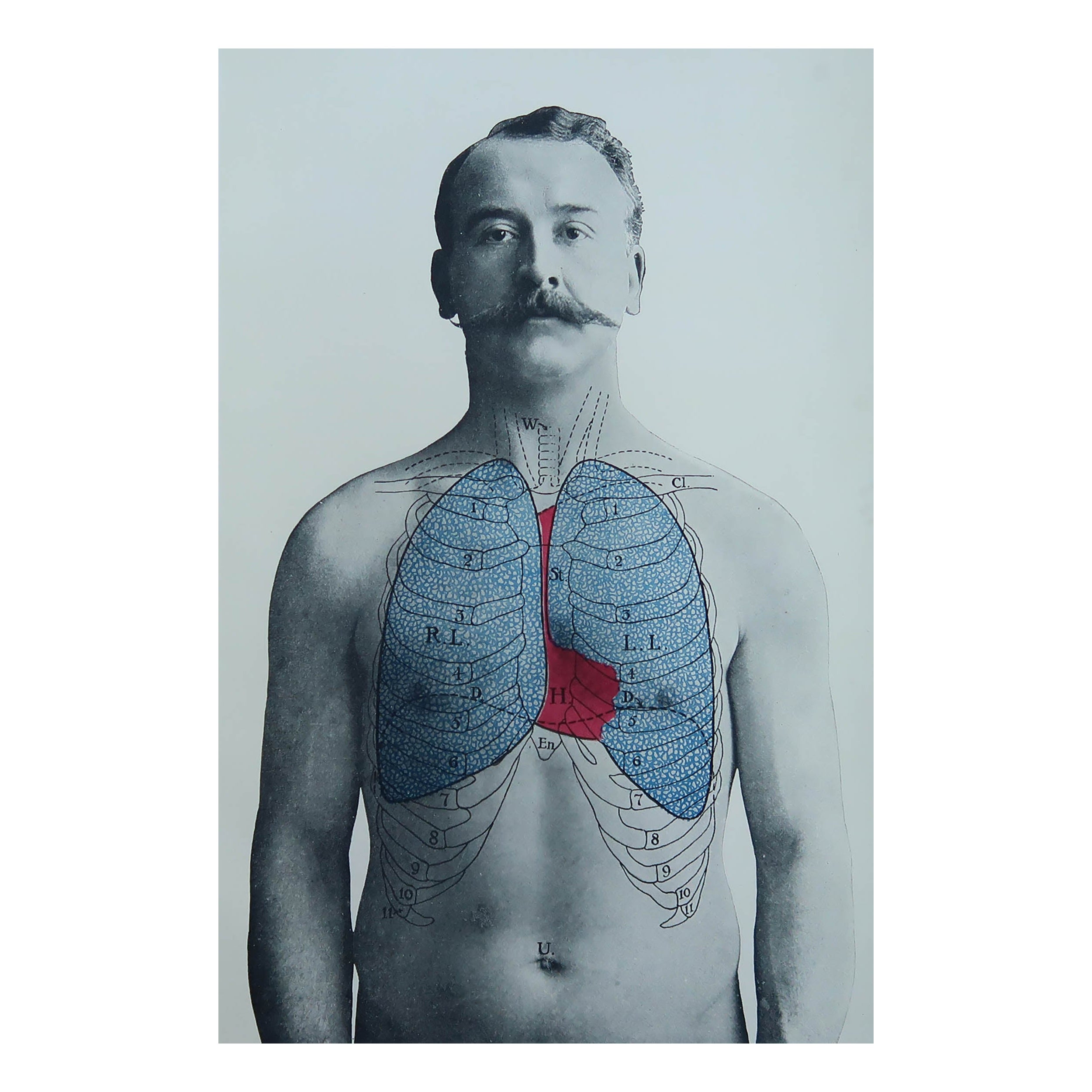 Original Vintage Medical Print, Lungs, C.1900 at 1stDibs