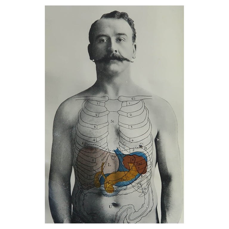 Impression médicale originale vintage, « Liver, Spleen and Pancreas ...