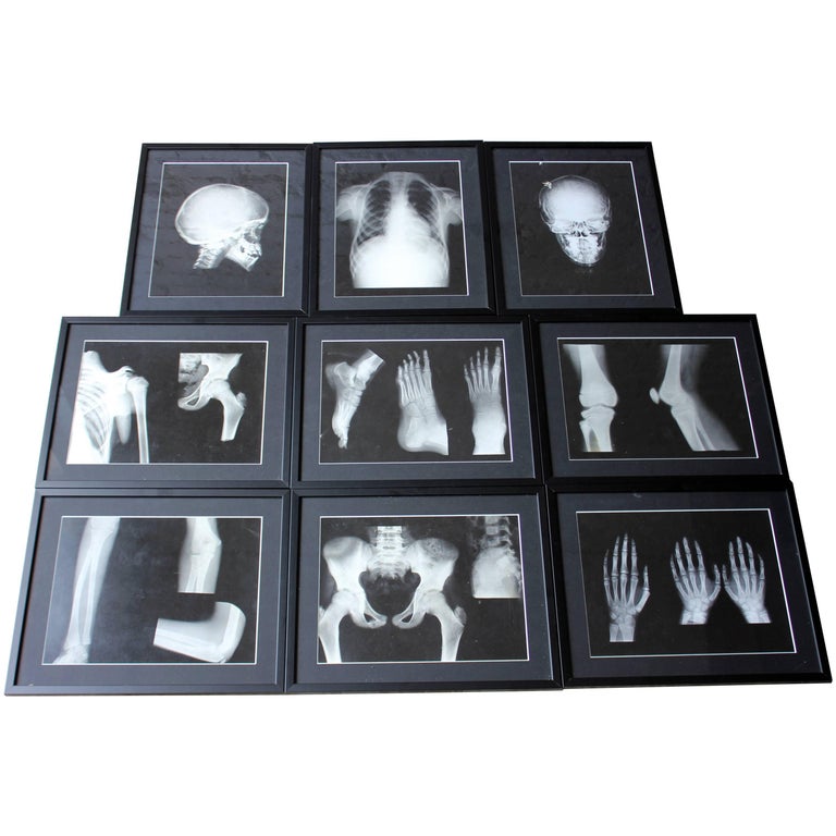 Group of Nine Framed Mid-Century Medical X-Ray Imaging Teaching Aids at ...
