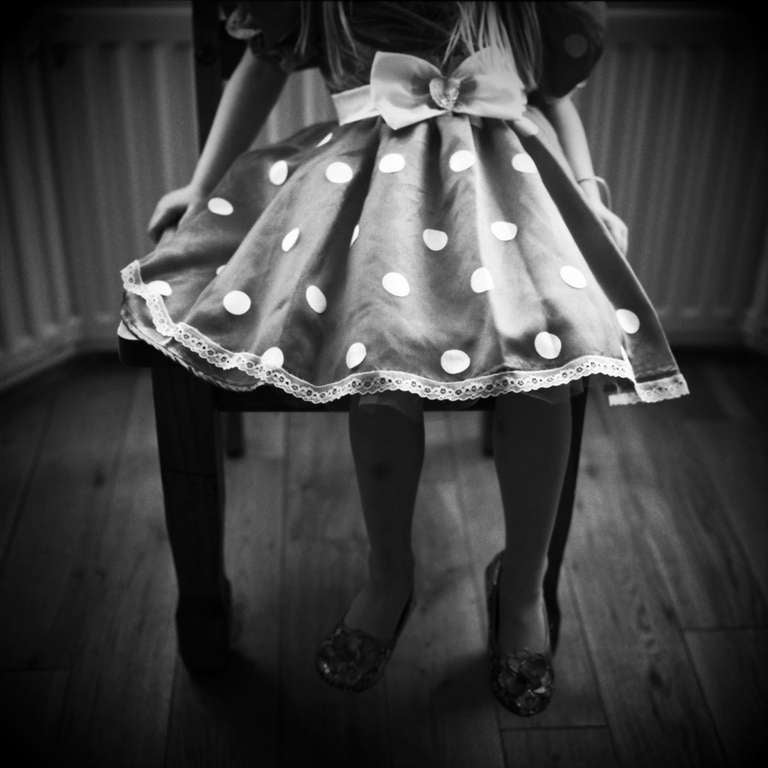 Deborah Parkin - Bruised Leg For Sale at 1stDibs