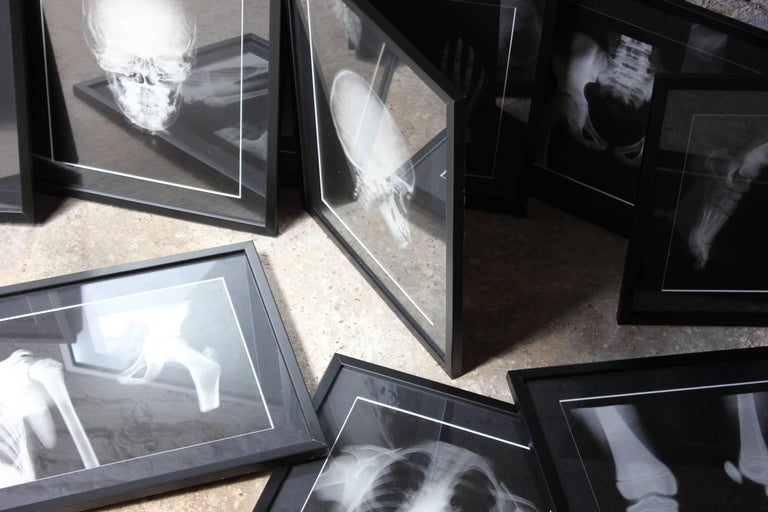 Group of Nine Framed Mid-Century Medical X-Ray Imaging Teaching Aids at ...