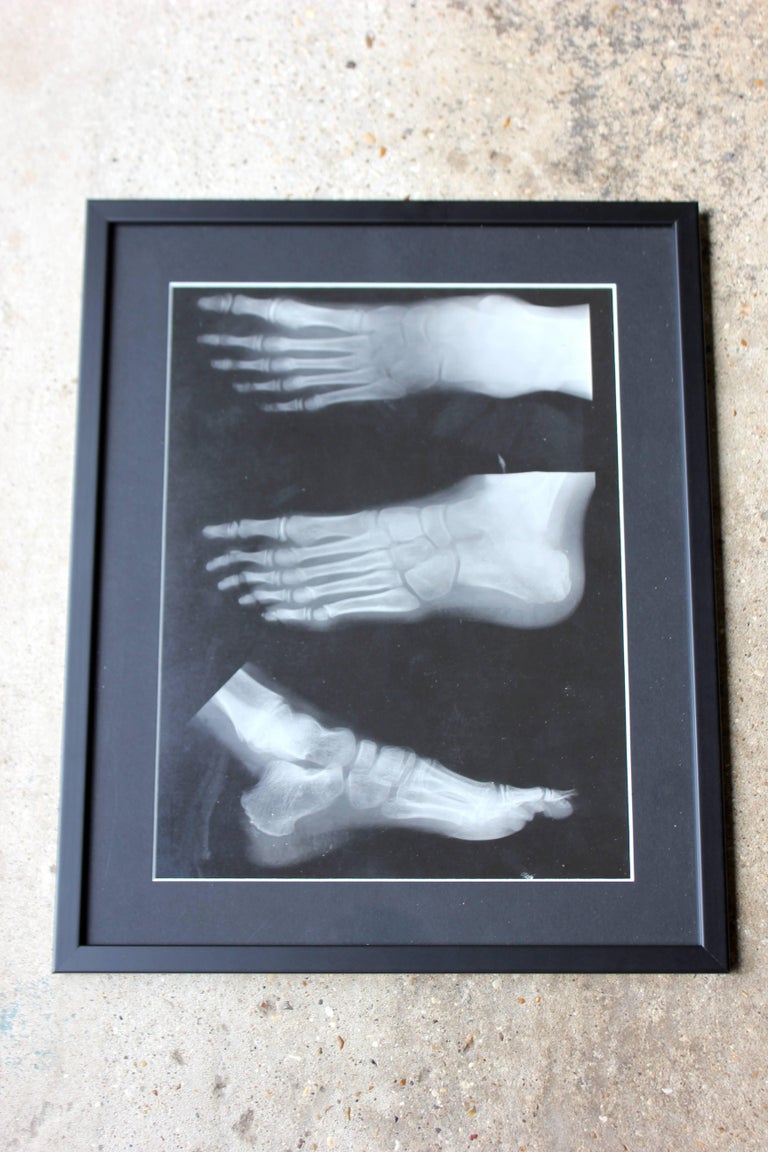 Group of Nine Framed Mid-Century Medical X-Ray Imaging Teaching Aids at ...