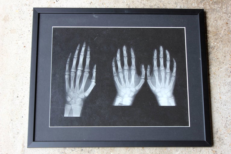 Group of Nine Framed Mid-Century Medical X-Ray Imaging Teaching Aids at ...