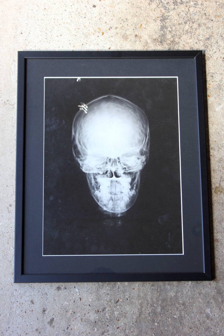 Group of Nine Framed Mid-Century Medical X-Ray Imaging Teaching Aids at ...