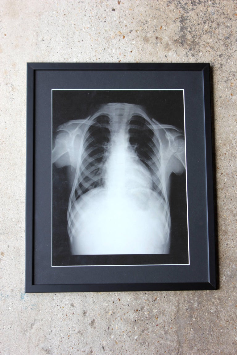 Group of Nine Framed Mid-Century Medical X-Ray Imaging Teaching Aids at ...