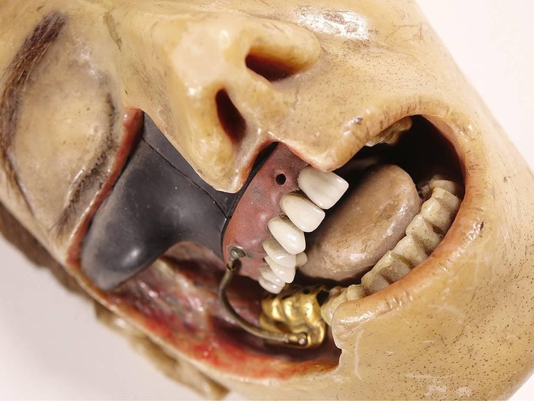 Highly Detailed Early 1800s Wax Dental Model For Sale at 1stDibs