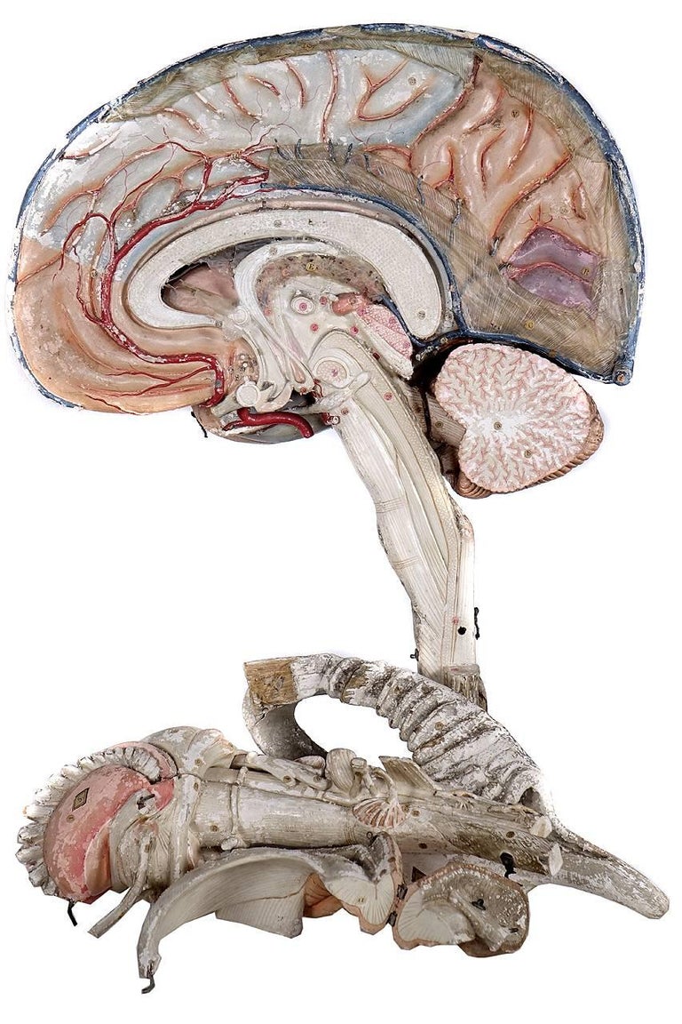 Large 19th Century Dr. Auzoux Paper Mache Model of Brain at 1stDibs