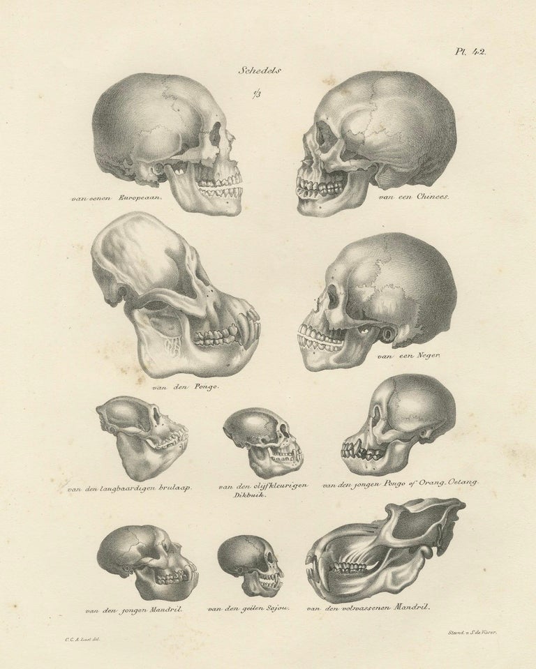 skull comparison