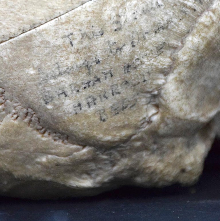 Deformed Human Skull 0.3 at 1stDibs