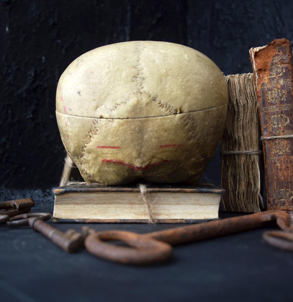 Deformed Human Skull 0.3 at 1stDibs | human skull for sale, human ...