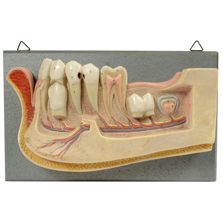 Didactic Resin Anatomical Model of an Enlarged Jaw, Germany, 1950s For ...