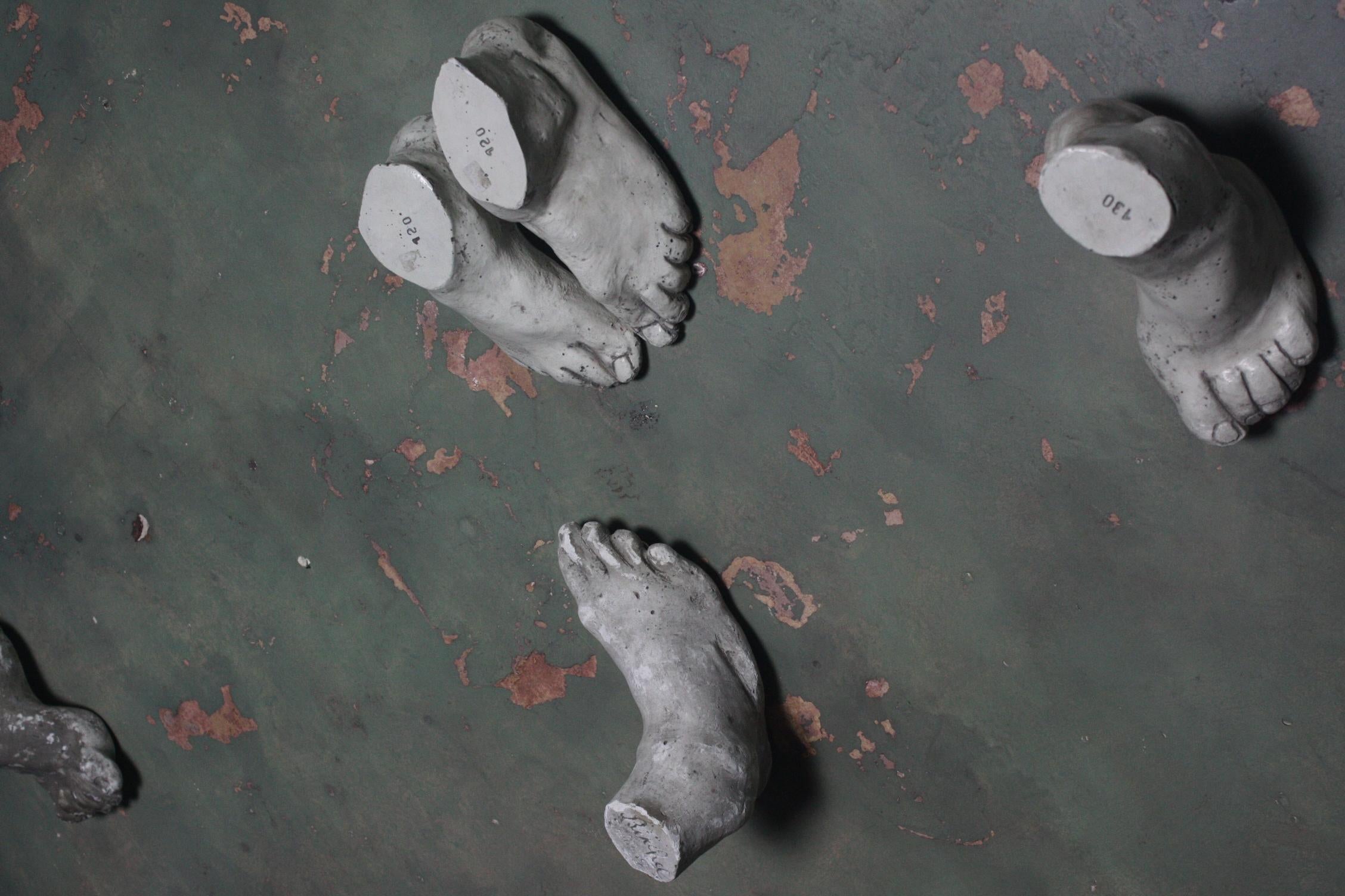 Early 20th Century Collection of Ceramic and Plaster Orthopedic ...