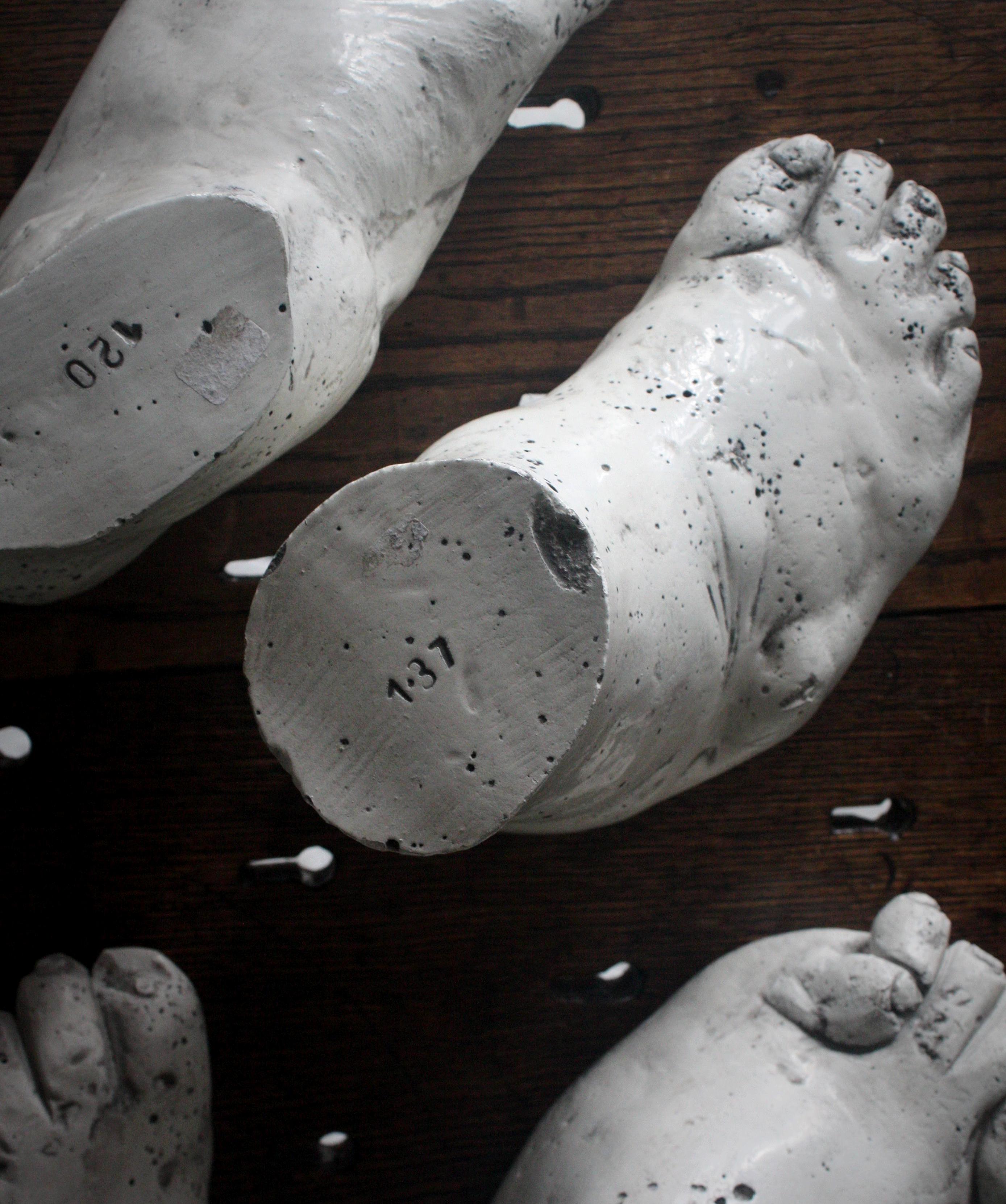 Early 20th Century Collection of Ceramic and Plaster Orthopedic ...