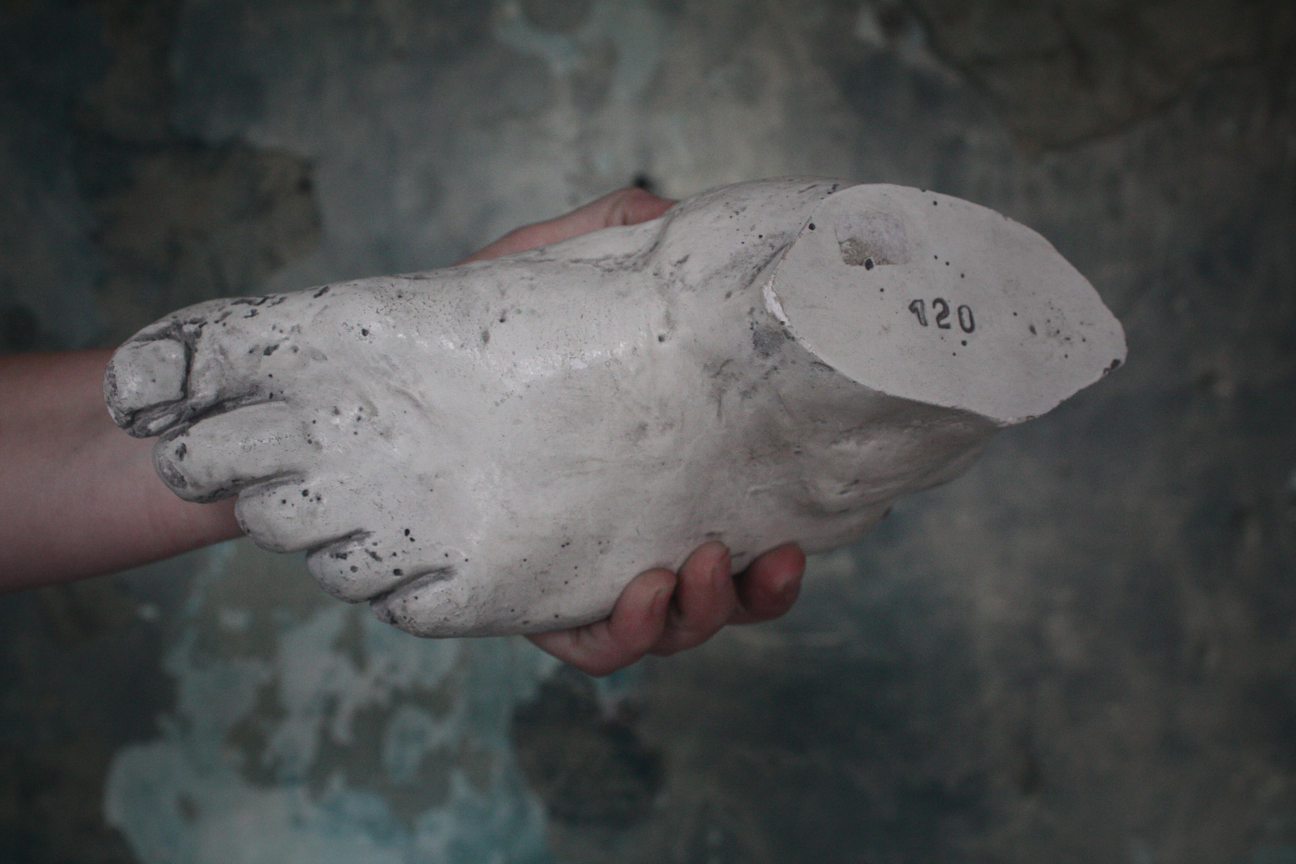 Early 20th Century Collection of Ceramic and Plaster Orthopedic ...