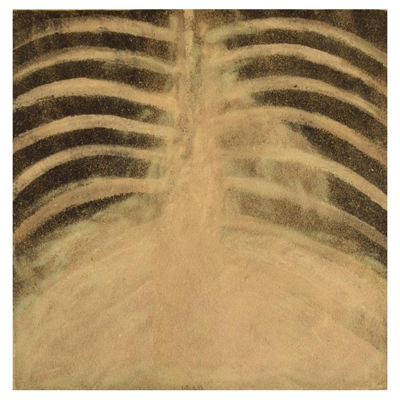 Tony Robbin Acrylic on Canvas Backed on Board For Sale at 1stDibs