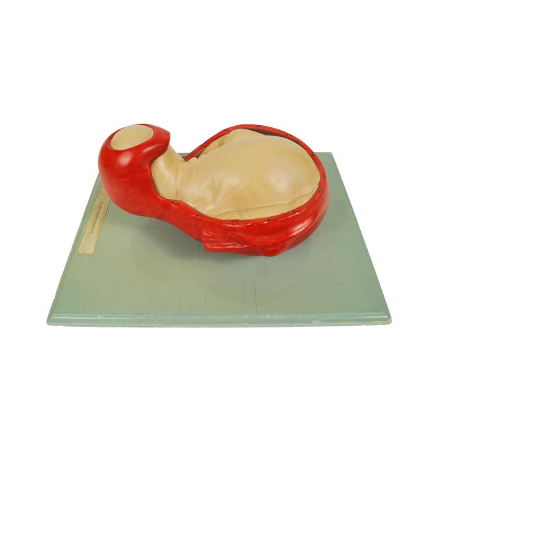 German Anatomic Model of Baby Birthing 1940s at 1stDibs