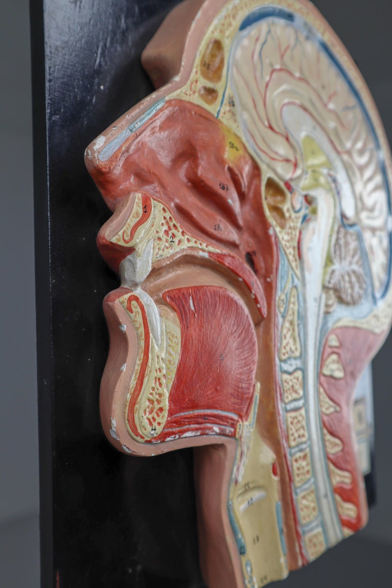 Human Half Head Anatomical on Plaster, Wood and Metal Base Czech ...