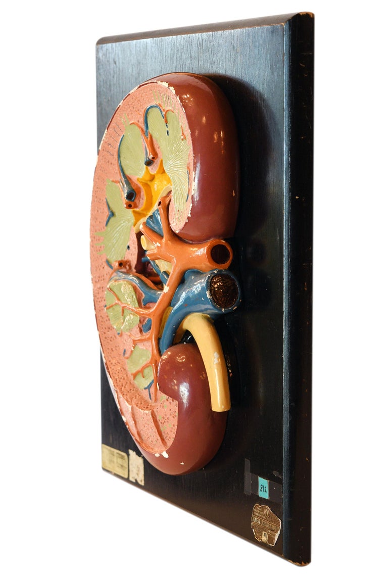 Kidney Cross Section Model at 1stDibs