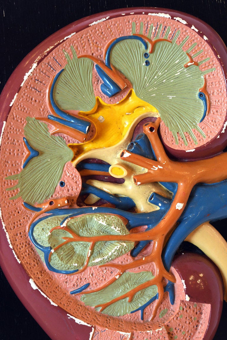 Kidney Cross Section Model at 1stDibs
