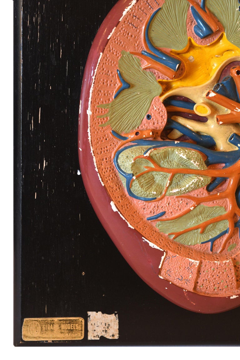 Kidney Cross Section Model at 1stDibs