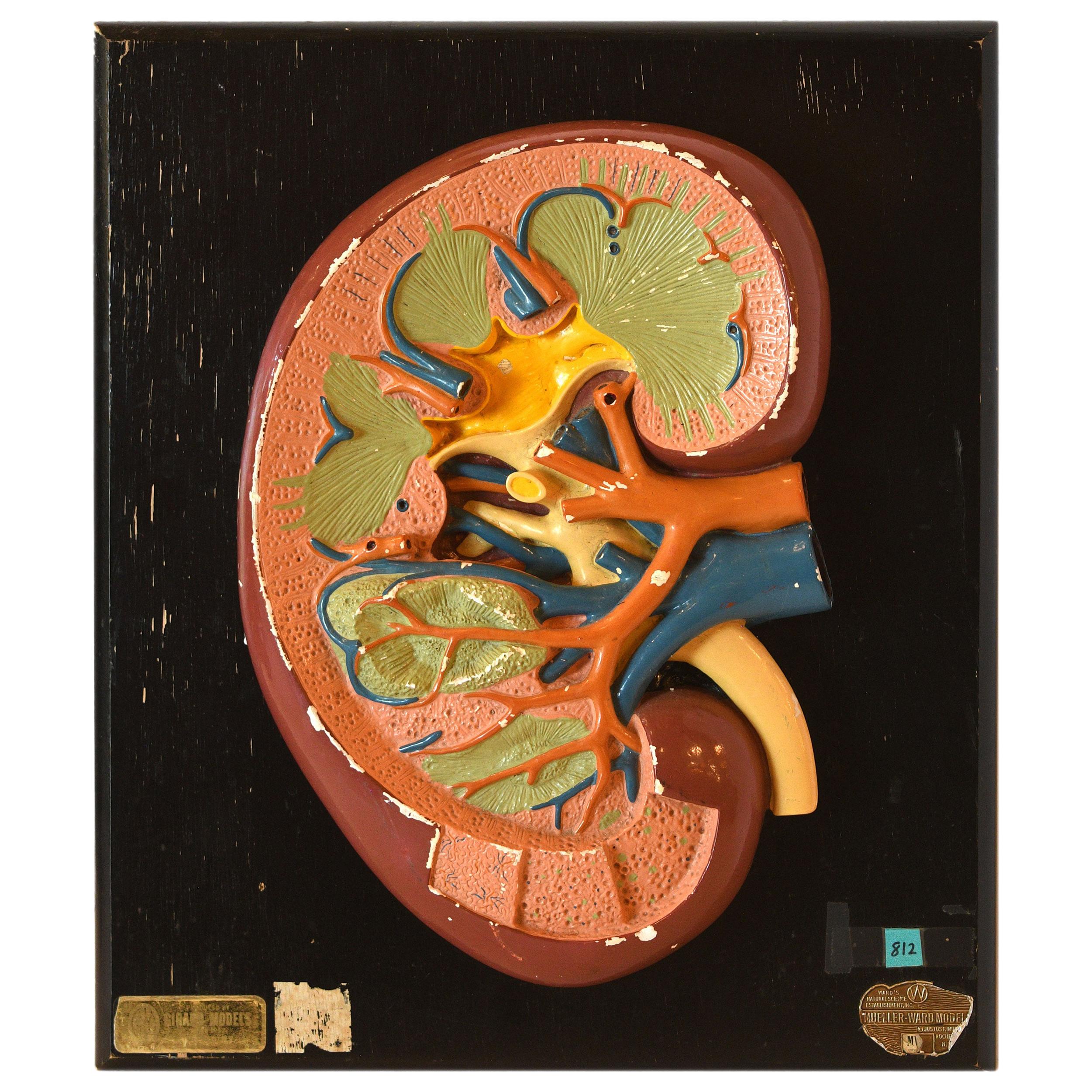 Kidney Cross Section Model at 1stDibs