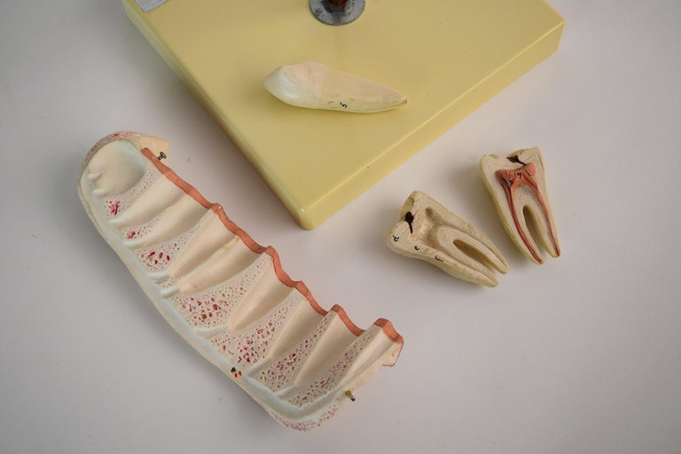 Large Mid-Century Modern Didactic Resin Anatomical Model Jaw For Sale ...