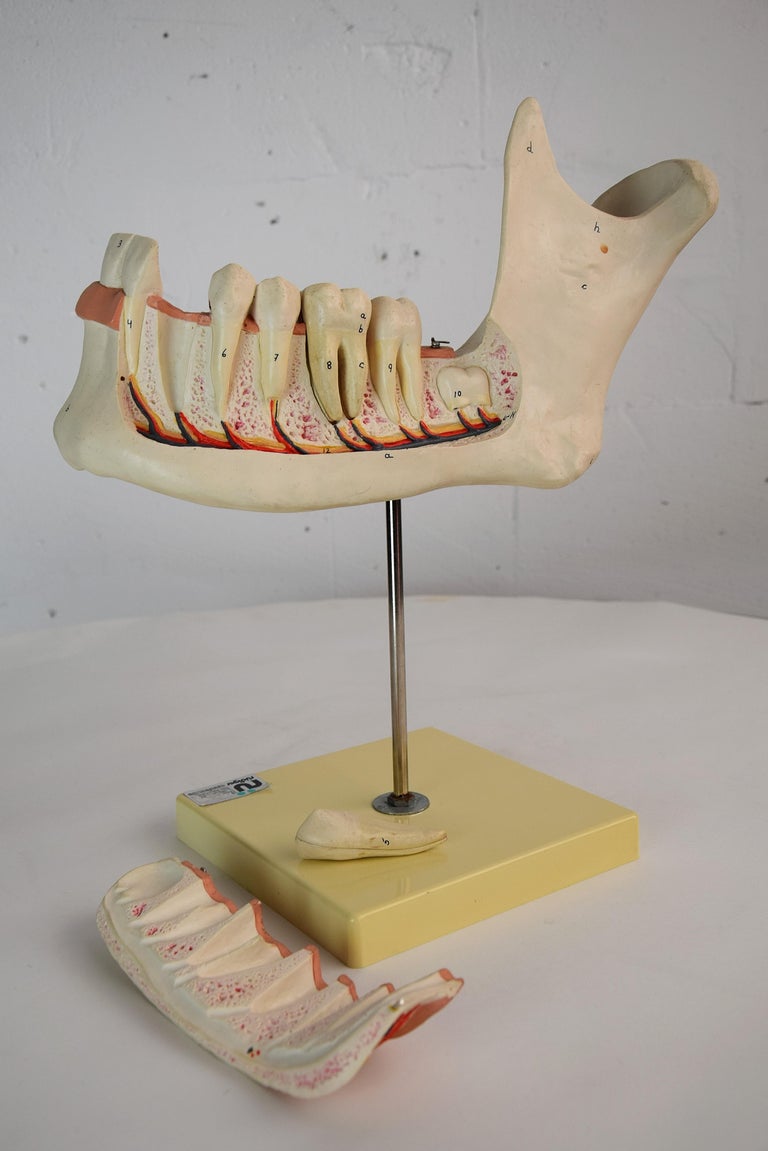 Large Mid-Century Modern Didactic Resin Anatomical Model Jaw For Sale ...